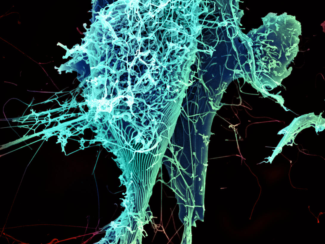 String-like Ebola virus peeling off an infected cell | National ...