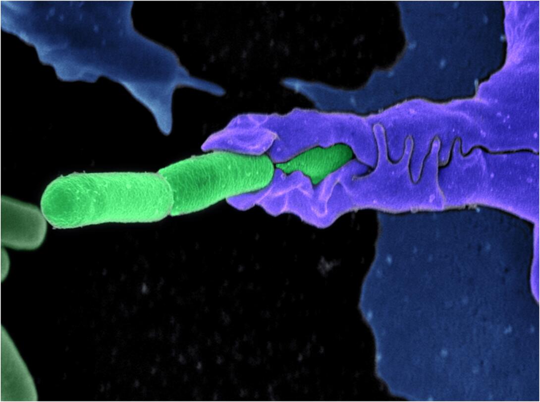 Anthrax bacteria (green) being swallowed by an immune system cell ...