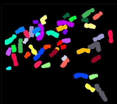 Color-coded chromosomes | National Institute of General Medical Sciences