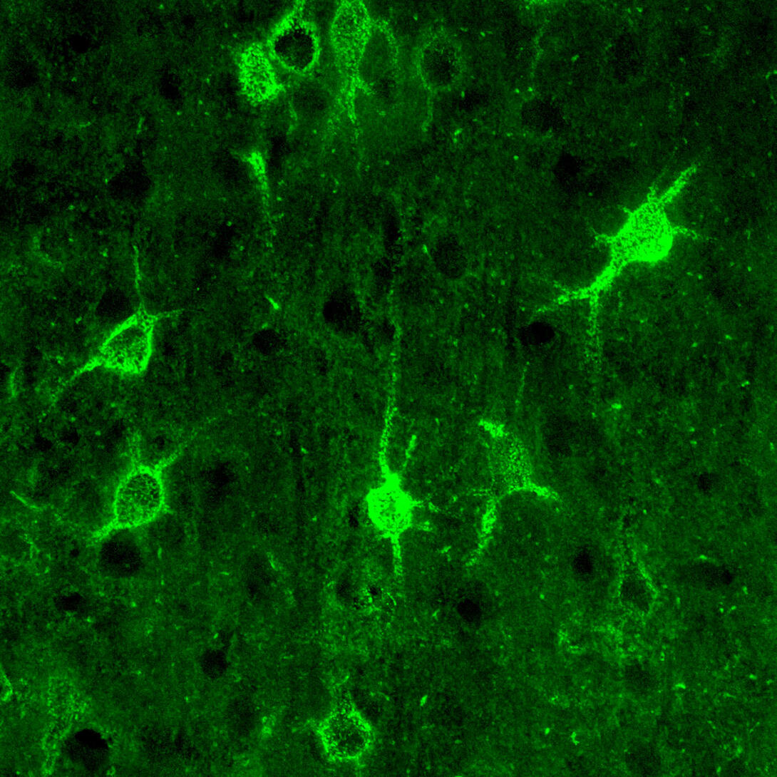 Confocal microscopy of perineuronal nets in the brain 1 | National ...