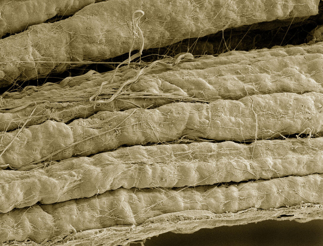 A bundle of myelinated peripheral nerve cells (axons) | National ...