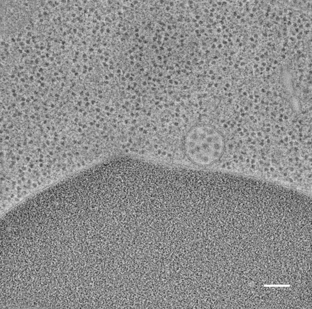 Multivesicular bodies containing intralumenal vesicles assemble at the ...