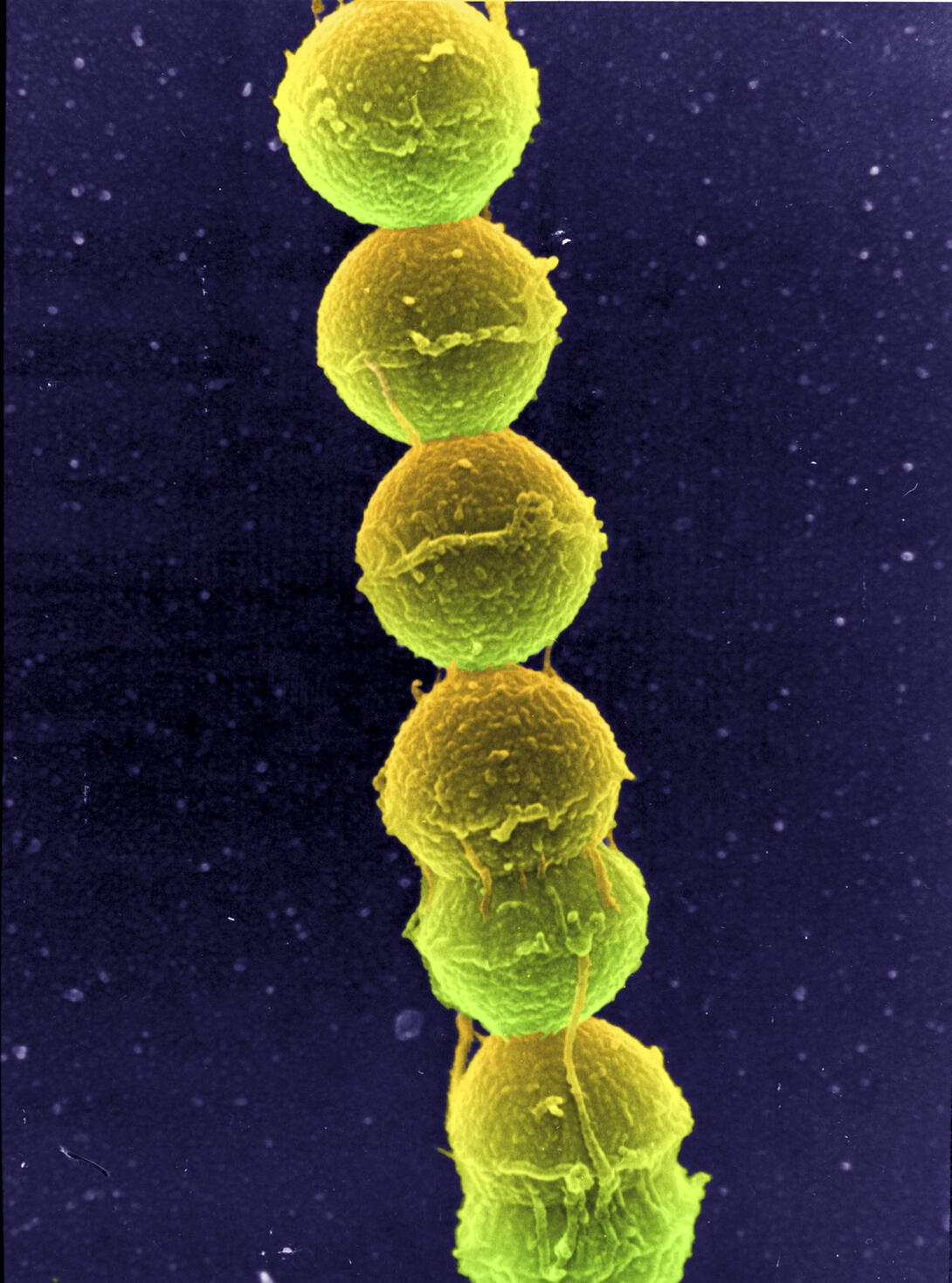 streptococcal bacteria